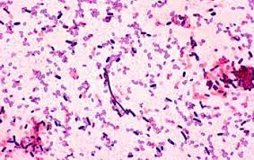 Bacillus licheniformis | Premium Probiotic (5.0*1011 CFU) - Molkem